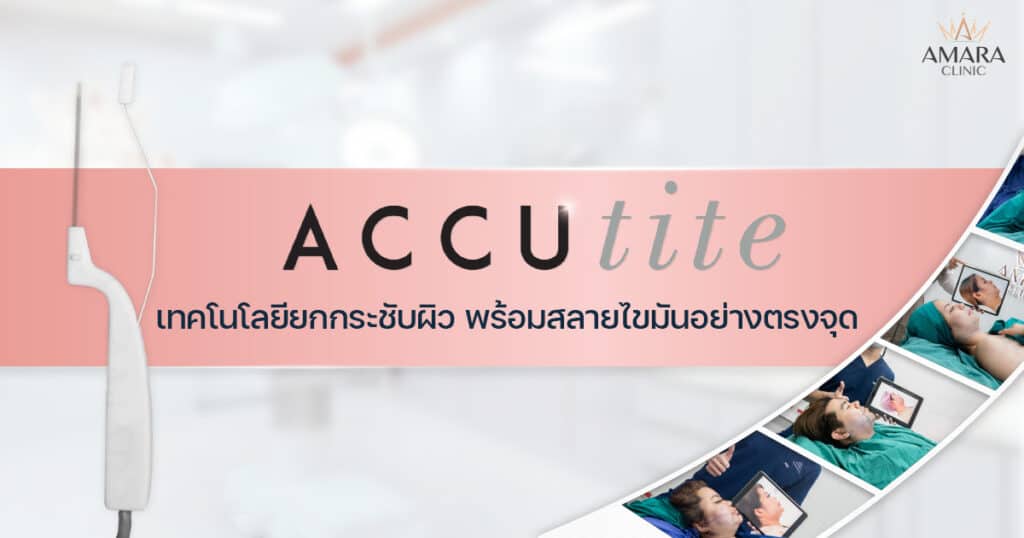 ACCUtite เทคโนโลยียกกระชับผิว สลายไขมันในหนึ่งเดียว!